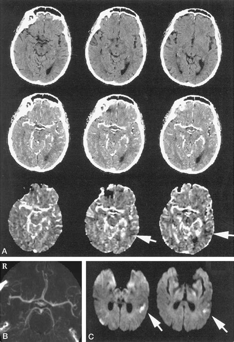Figure 5 From Three Dimensional Functional Ct Early Anatomy In
