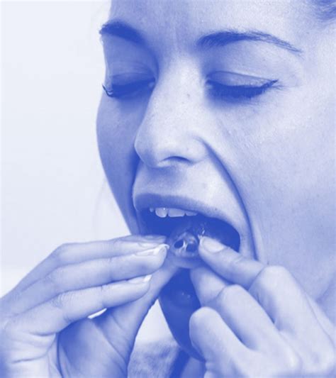 Tonge1 Lorthodontie Par Nutislab®