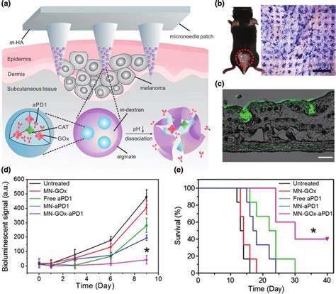 Microneedle Patch For Enhanced Efficacy Of Checkpoint Blockade Antibody Download Scientific
