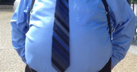 Weight Loss Progress Pic From April 2017 418 Lbs To November 2018