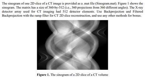 Solved The Sinogram Of One 2d Slice Of A Ct Image Is