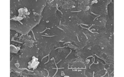Microbial Methane Farming