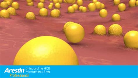 Arestin Chapel Hill Periodontics And Implants