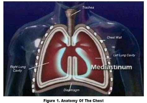 [pdf] Chest Tube And Drainage Management Semantic Scholar