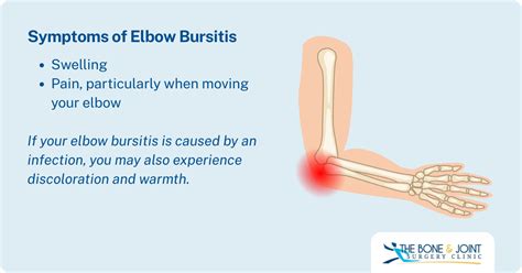 4 Therapies For Elbow Bursitis When Is Surgery Required