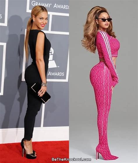 Beyonce Plastic Surgery Comparison Photos