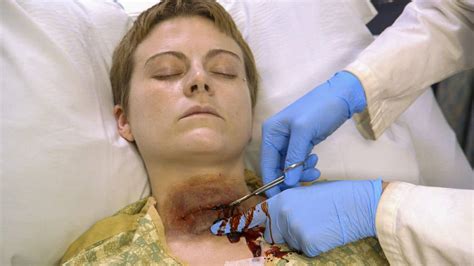 Thyroidectomy And Parathyroidectomy Post Op Care Chapter 7 Bedside