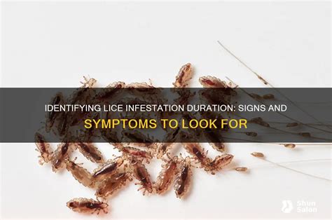 Identifying Lice Infestation Duration Signs And Symptoms To Look For