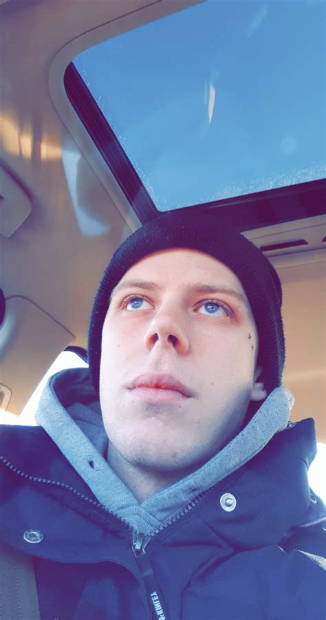 Over 18 Dry Lips What To Expect In Winter Scrolller