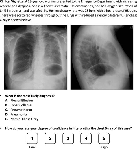 A Question From The Survey On A Left Upper Lobe Collapse Case