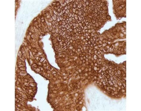 Immpact Dab Eqv Peroxidase Hrp Substrate Chromatographic Specialties Inc