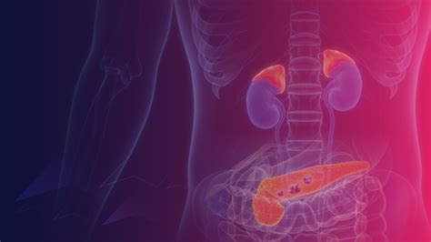 Identifying And Managing Hypercortisolism In Type 2 Diabetes Mycme