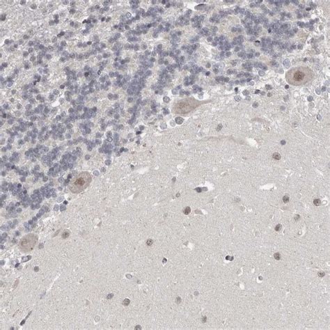 Pa5 56012 Invitrogen Antibodies Srcap Antibody Antibodypedia