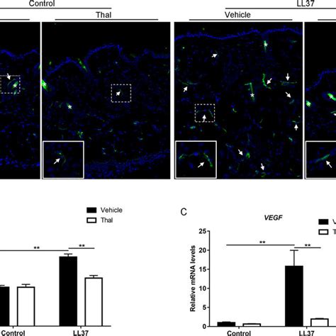Thalidomide Suppresses Cutaneous Angiogenesis In Ll37 Induced