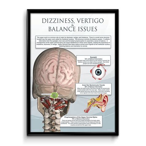 Upper Cervical Specific Chiropractic Posters Digital Chiropractic