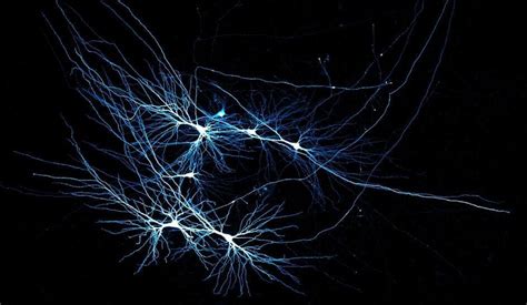The Unique Neural Wiring Of The Human Hippocampus May Maximize Memory