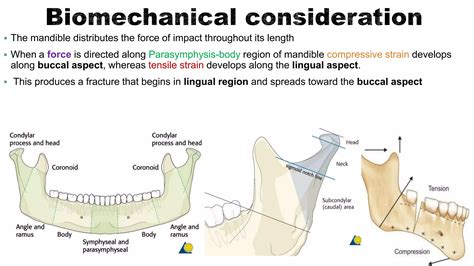 Mandibular Fractures Pptx