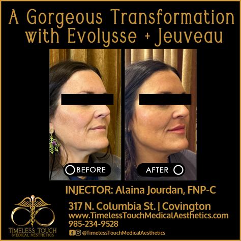 Check Out This Timeless Touch Medical Aesthetics Facebook
