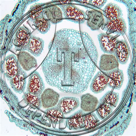 Sambucus Canadensis Flower Bud 2 Level Cs Prepared Microscope Slide