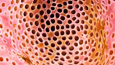 Apa Itu Tryphobia Simak Penjelasan Penyebab Gejala Diagnosis Dan