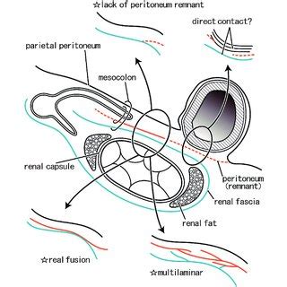 Anatomy Of Toldts Fascia Or A Fusion Fascia Behind The Mesoclon Three