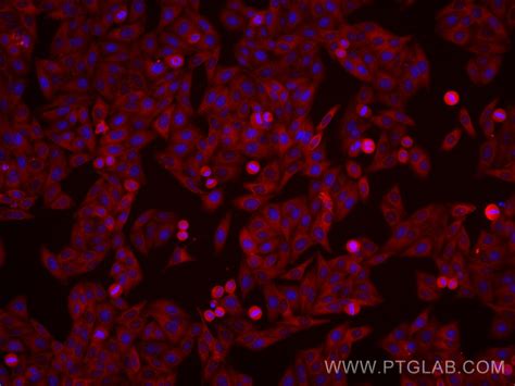hexokinase 2 antibody 66974 1 pbs proteintech