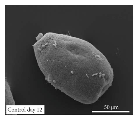 Images At Scanning Electron Microscope Of E Granulosus Ss