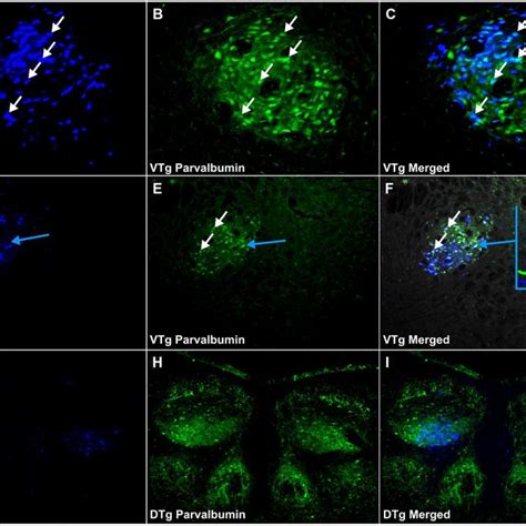 Dorsal Tegmental Nucleus Of Gudden A C Low Magnification 50× Download Scientific Diagram
