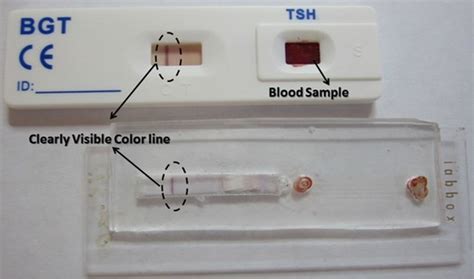 Self Driven Microfluidic Filter For Seperating Liquid From A Liquid