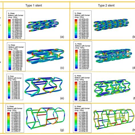 Pdf 4d Printing Of Personalized Shape Memory Polymer Vascular Stents