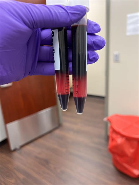 Issues With Lymphocyte Isolation Pictures R Labrats