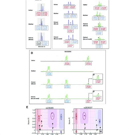 Str Analysis Of Chromosome 21 To Identify Origin Of The Extra Download Scientific Diagram