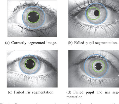 Figure 1 From An Automated Method For Predicting Iris Segmentation