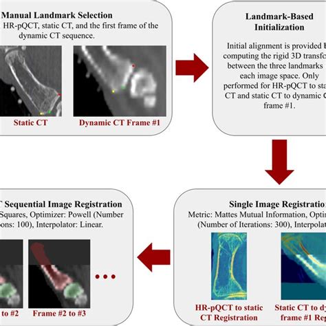 overview of the image registration pipeline intensity based