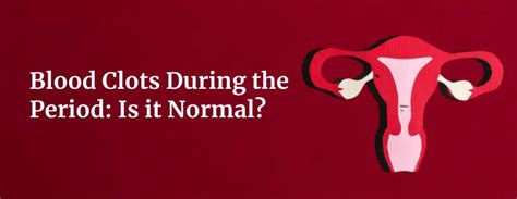 Extremely Large Blood Clots Menstrual What Does Your Period Blood