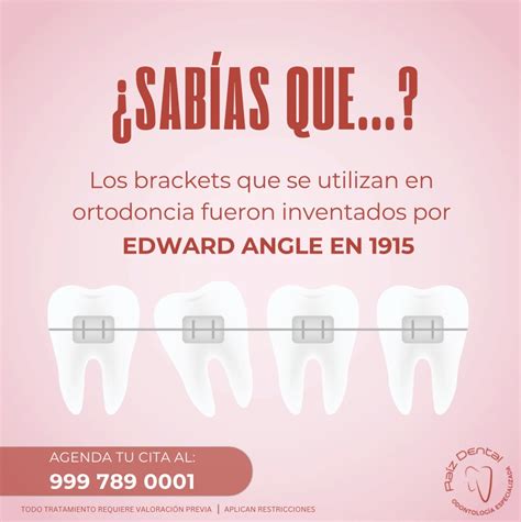 Raíz 🦷 Edward Angle El Genio Detrás De La Sonrisa Perfecta 🦷 ¿sabías Que Los Brackets Tal