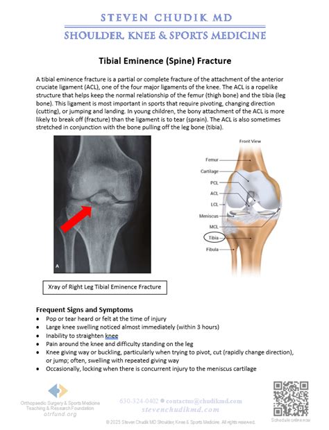 Tibial Eminence Spine Avulsion Steven Chudik Md