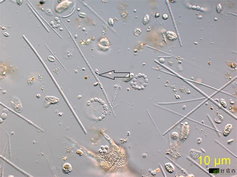 矛丝藻属束丝藻科念珠藻目nostocophycidae蓝藻纲蓝藻细菌门细菌界细菌域生物学分类系统查物种好易查