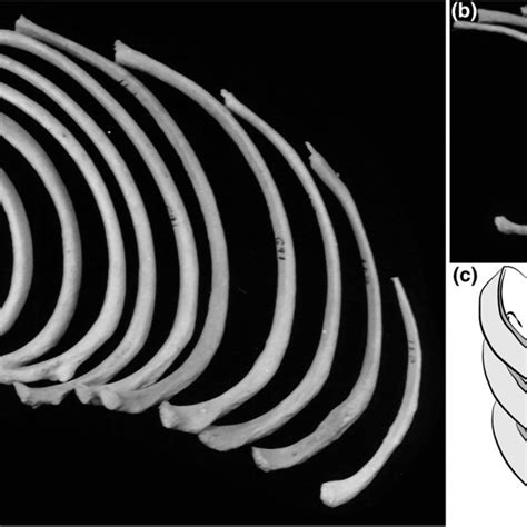 Rib Sequencing And Identification A Right 1st To 12th Ribs Arranged