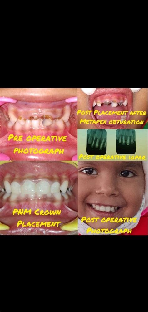 Dr Asmita Das Posted On Linkedin