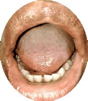 Tongue S Tenor