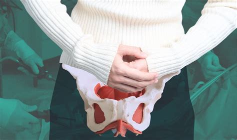 Evaluación Del Prolapso De órganos Pélvicos Urogyn