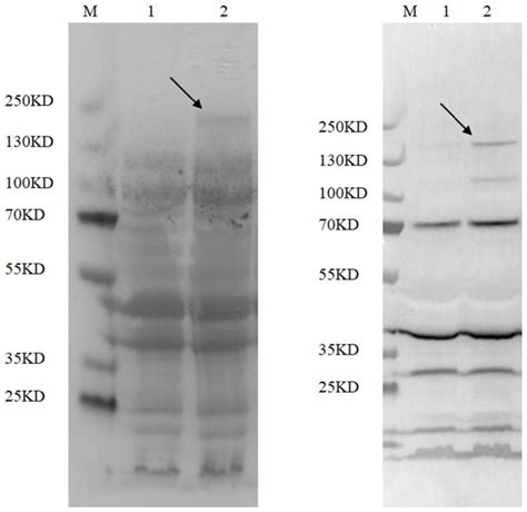 一种肉毒毒素的制备方法与流程