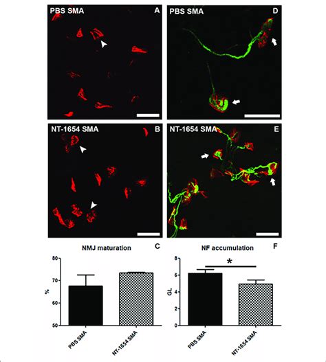 Analysis Of Diaphragm Nmjs A C Evaluation Of Nmj Maturation By Download Scientific Diagram