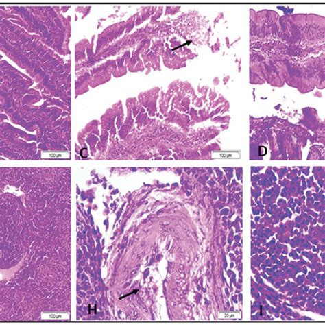 Representative Micrographs Of Transmission Electron Microscope Of Download Scientific Diagram