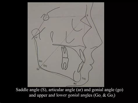 Bjorkand Jarabak Cephalometric Analysis Ppt