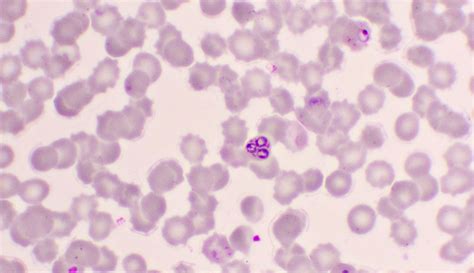 Plasmodium Microscope Plasmodium Falciparum Microscope Hi Res Stock