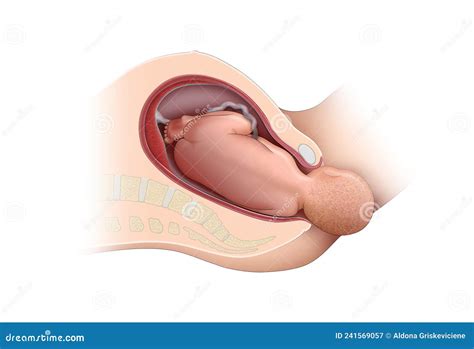 Stages Of Vaginal Delivery