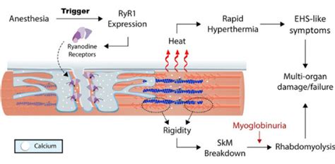 Malignant Hyperthermia Quiz Mcq Quiz And Trivia