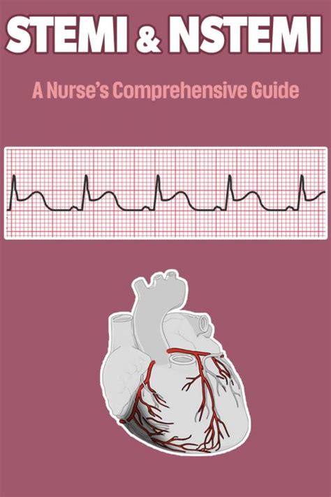 Stemi And Nstemi A Nurses Comprehensive Guide Health And Willness